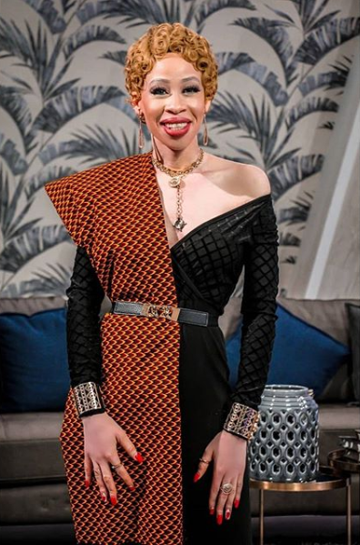 Refilwe Modiselle Biography: Age, Albinism, White Gold, Career, Net worth