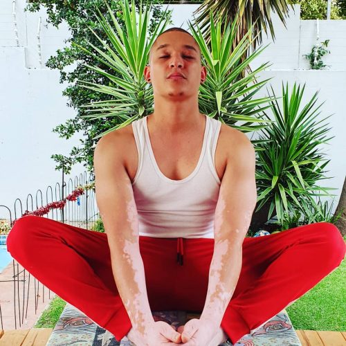 Brighton Ngoma Biography: Age, Wife, TV Roles, Vitiligo, Net Worth, Cars